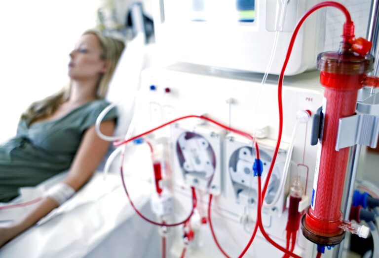 Dialysis Care in Bangalore | Dialysis in the ICU setting - DR. PALLAVI ...